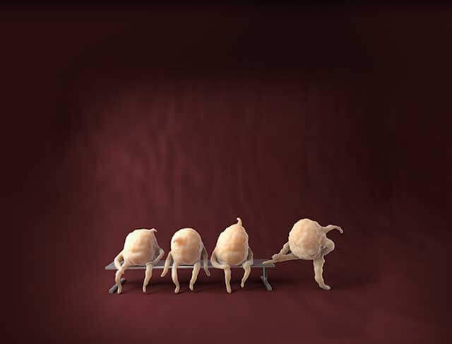 KENGREAL® (cangrelor) | Official HCP Site